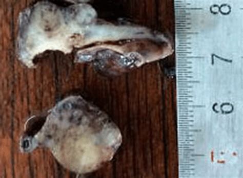 Gross Appearance Of The Epididymis The Epididymis Is Enlarged And Download Scientific Diagram