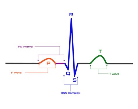 Electrocardiogram Diagram