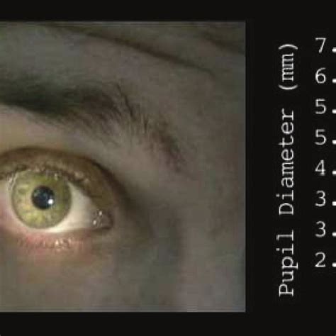 Estimating Pupil Diameter From A Rectangular Region Containing Only The
