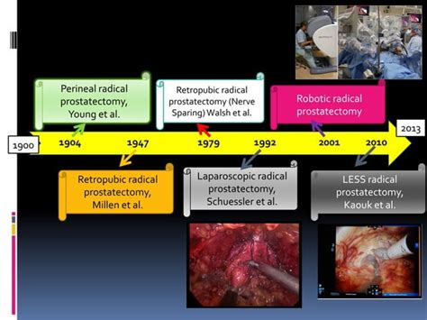 Open Laparoscopic And Robotic Approaches Ppt