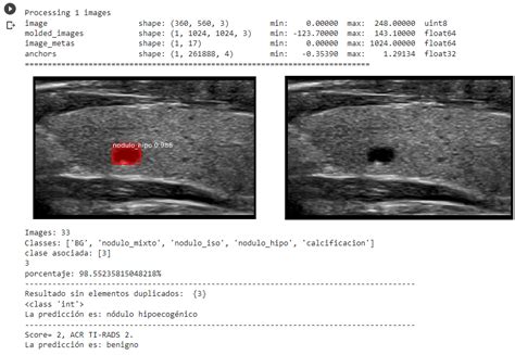 GitHub GuCuChiara Thyroid Mask RCNN Mask R CNN For Thyroid Nodules Detection And Instance