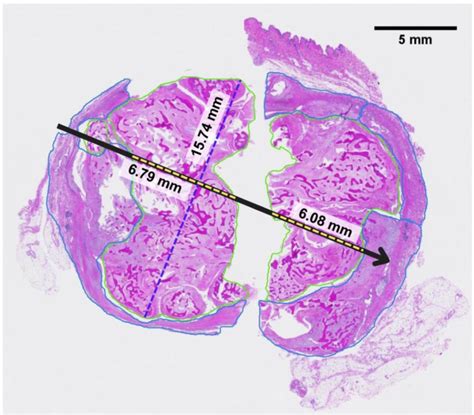 Figure 4 From Thermal Characterization And Preclinical Feasibility Verification Of An Accessible