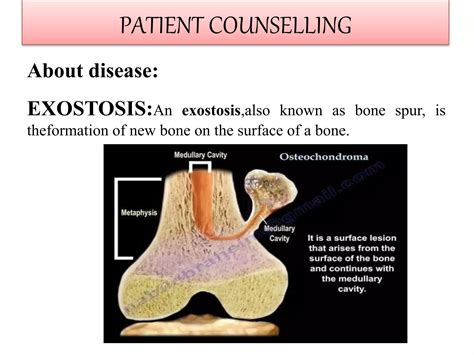 Left Femur And Tibia Exostosis Ppt
