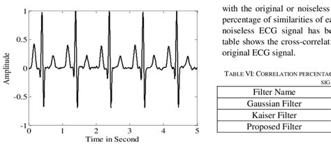 Filtered Ecg Signal Using Gaussian Window Based Fir Low Pass Filter Download Scientific Diagram