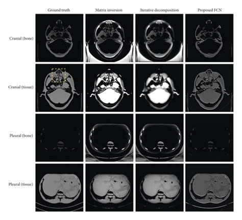 Image Decomposition Algorithm For DualEnergy Computed Tomography Via Fully Convolutional