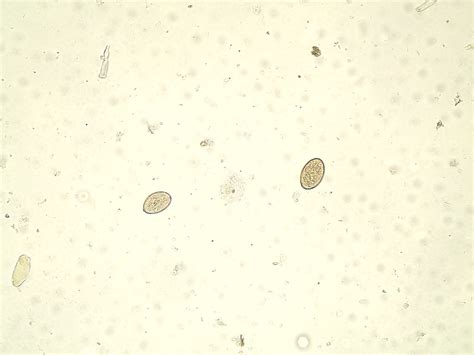 Hookworm Eggs Slide Prepared Slides