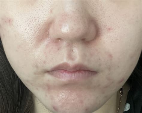 선크림 한번도 안바르고 맨날 파데만 바르는 선크림 유목민임다 ⭐️﻿위 사진이 쌩얼