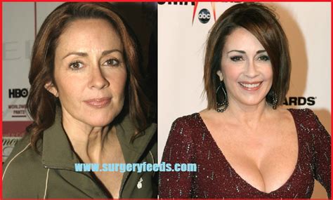 Patricia Heaton Before And After The Future Of Everybody Loves Raymond