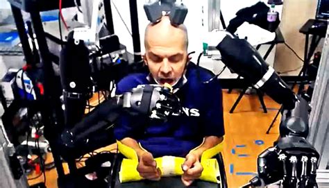 Watch A Man Eat Cake With Mind Controlled Robot Arms Futurity