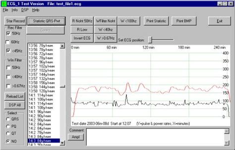 Ecg Recording Storing Filtering And Recognition Codeproject