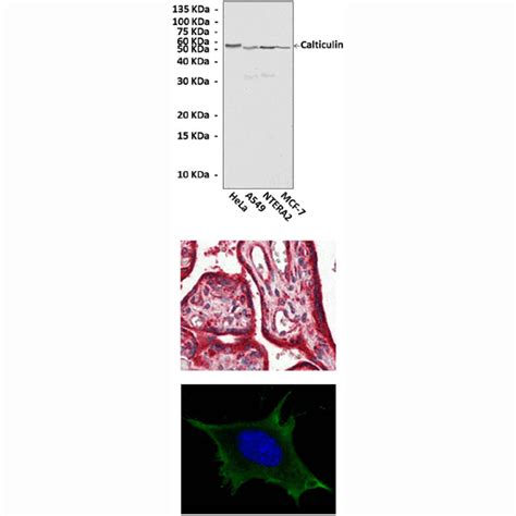 Anti Calreticulin Mouse Calreticulin Antibody Cell Applications