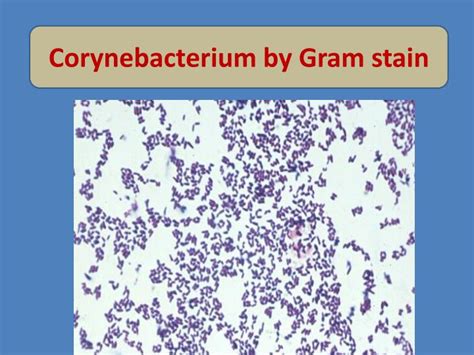 Ppt Corynebacterium Diphtheriae Powerpoint Presentation Id3672369
