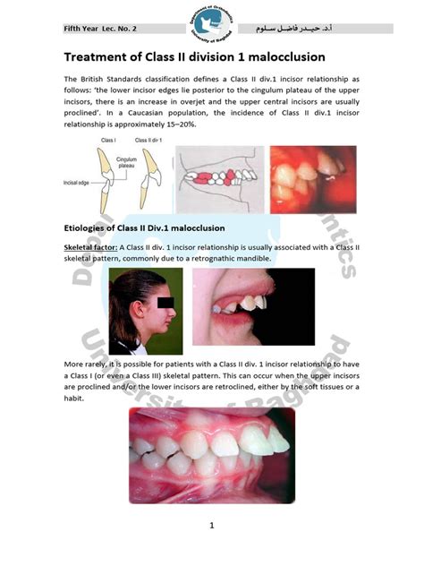 Lec 17 Treatment Of Class Ii Div 1 Malocclusion ا د حيدر فاضل سلوم Pdf Orthodontics