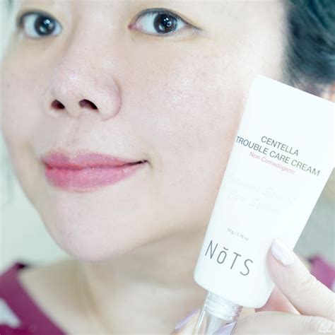 여드름크림 추천 비건화장품 낫츠 센텔라 트러블 케어 크림 턱트러블 사용후기 네이버 블로그