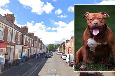 Xl Bully Leaves 5 Year Old Boy With Serious Head Injuries After Vicious