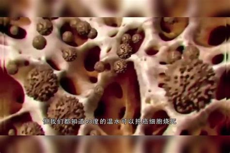 如果人类发烧到43度癌细胞会被热死吗网友你先被烧死 癌细胞 网友 人类