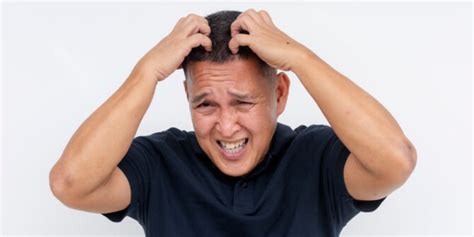Scalp Dysesthesia Symptoms Causes Diagnosis Treatment