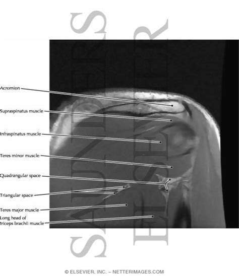 Quadrangular And Triangular Spaces