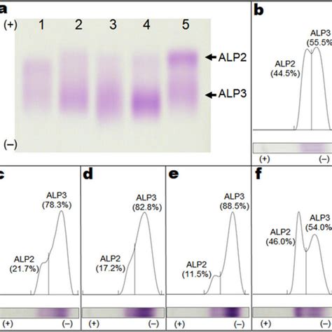 Pdf Determination Of Serum Bone Specific Alkaline Phosphatase