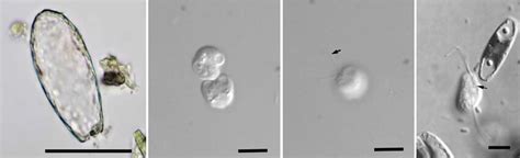 Photomicrographs Of Cercozoa A C And Euglenozoa D A Euglypha