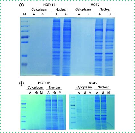 Nonspecific Binding Proteins With Different Beads Protein A A Or Download Scientific Diagram
