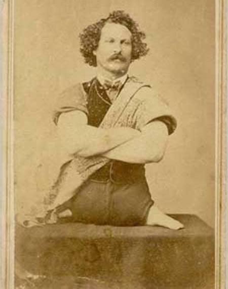 Weird News 10 Most Strange People With No Legs