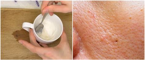 Without Using A Scrub This Is How To Make Pores Smaller And Remo