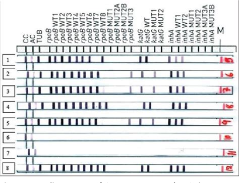 Figure 1 From Multidrug Resistant Tuberculosis Detection And