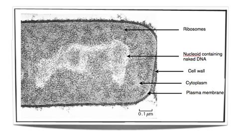 Electron Micrograph Of A Prokaryotic Cell Prokaryotic Cell Biology Notes Biology