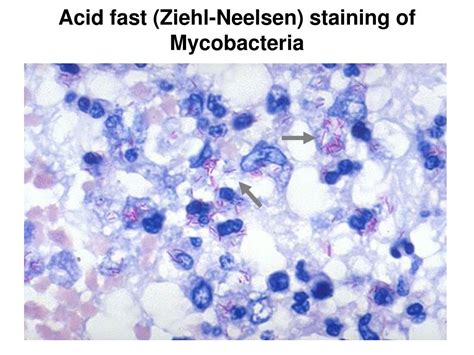 Ppt Mycobacteria Powerpoint Presentation Free Download Id328083