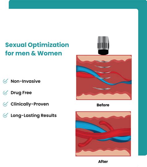 GAINSWave Therapy In Maui HI Maui Longevity RX