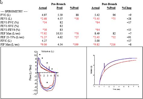 Restrictive Spirometry Bronchiectasis At Elijah Newton Blog