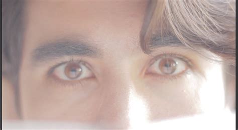 Redness And Scleral Lenses Keratoconus