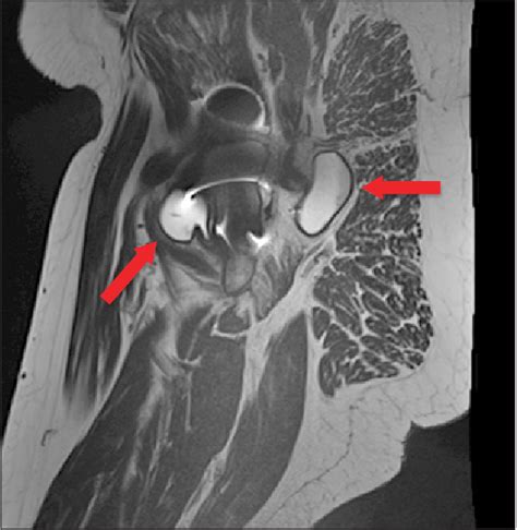 Motion Artifact Reduction In Magnetic Resonance Imaging At Geraldine Tusing Blog