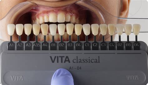 Online Open Access Dental Magazine Journal Publication Dentistry Journal