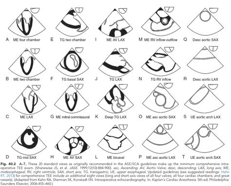 Tee Resident Elective — Uh Anesthesiology