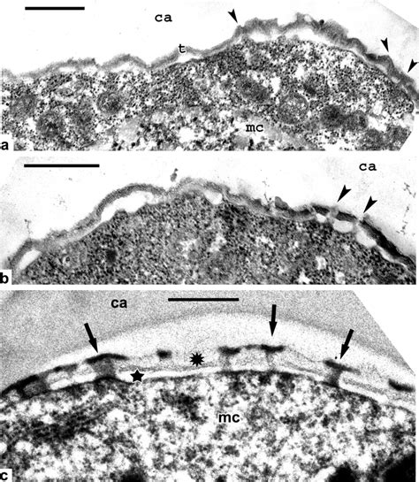 Late Tetrad Stage A B Slightly Oblique Sections Microspore Surface Download Scientific