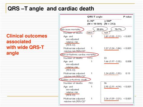 Ppt Understanding The Qrs T Angle Implications For Cardiac Health