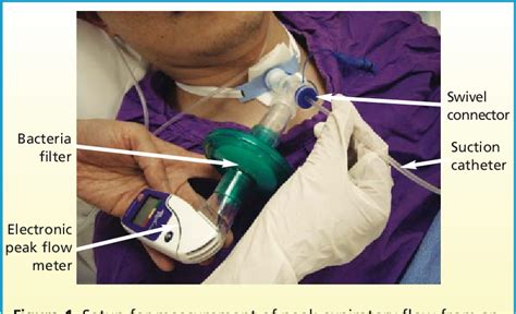 Figure 1 From Peak Flow Rate During Induced Cough A Predictor Of