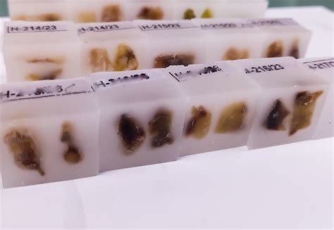 How Ffpe Tissue Samples Enhance Preventive Genomics Approaches To Precision Medicine How Ffpe Tissue Samples Enhance Preventive Genomics Approaches To Precision Medicine