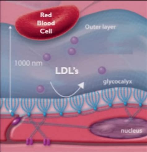 Does LDL Particle Size Really Matter
