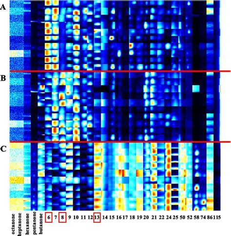 comparison of preoperative oscc patients with healthy controls the