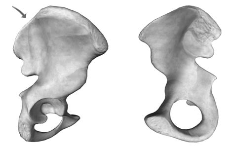 Medial And Lateral Views Of The Hip Bone Ilium Ischium Pubis Diagram Quizlet