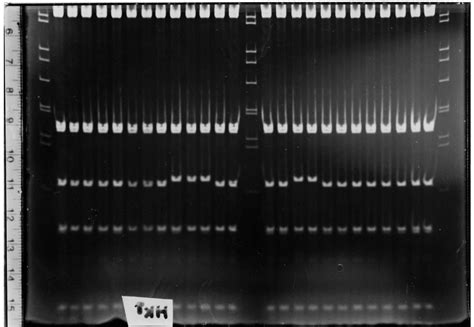 Polymorphism Insertions Deletions Detected After Amplification With