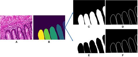 Input And Outputs Of Our Deep Gland Segmentation Network A Input