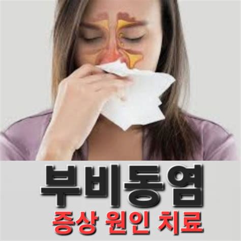 부비동염 증상 원인 치료 네이버 블로그