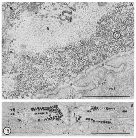 Electron Micrographs Of Portions Of A Neuromuscular Junction And Muscle Download Scientific