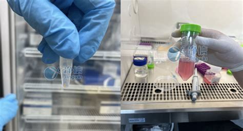 单细胞悬液制备仪对肝组织单细胞悬液制备步骤及实验效果 生物器材网