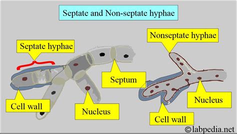 Fungal Infections Diagnosis And Treatment