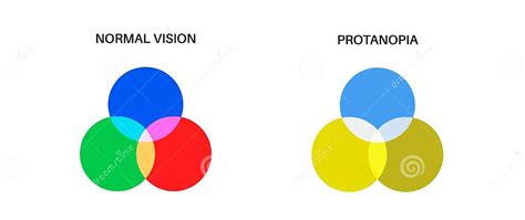 Protanomaly And Protanopia Stock Vector Illustration Of Dichromacy